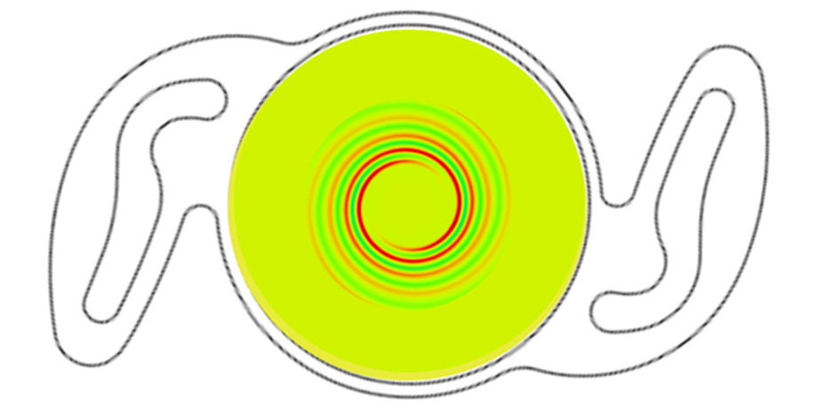 RayOne Galaxy – スゴ腕眼科医が教える白内障治療
