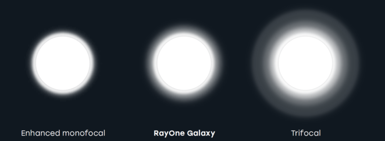 RayOne Galaxy – スゴ腕眼科医が教える白内障治療