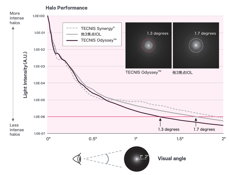 多焦点眼内レンズ・TECNIS Odyssey – スゴ腕眼科医が教える白内障治療