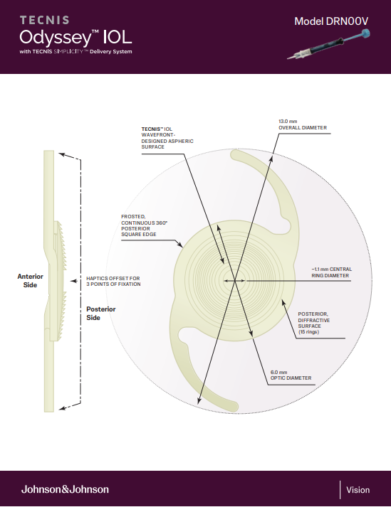 TECNIS Odyssey – スゴ腕眼科医が教える白内障治療